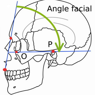 202009b-FacialAngle – CEH